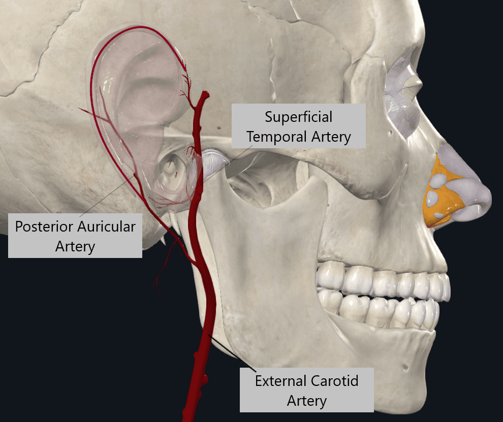 Local Tissue Advancement: Reconstructing Superior Helical Rim Defect ...
