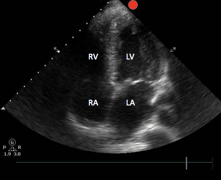 Introduction to Bedside Cardiac Ultrasound | Journal of Medical Insight