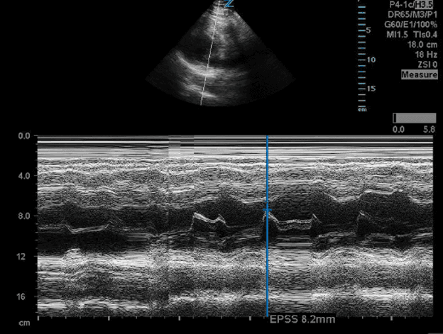 Introduction to Bedside Cardiac Ultrasound | Journal of Medical Insight