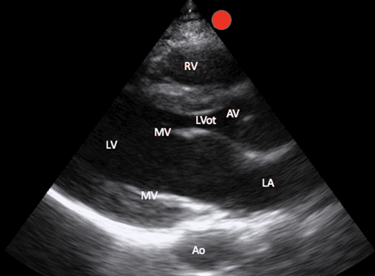 Introduction to Bedside Cardiac Ultrasound | Journal of Medical Insight