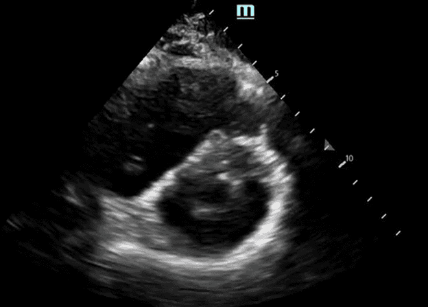 Introduction to Bedside Cardiac Ultrasound | Journal of Medical Insight