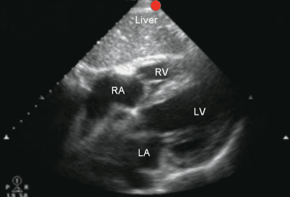 Introduction to Bedside Cardiac Ultrasound | Journal of Medical Insight