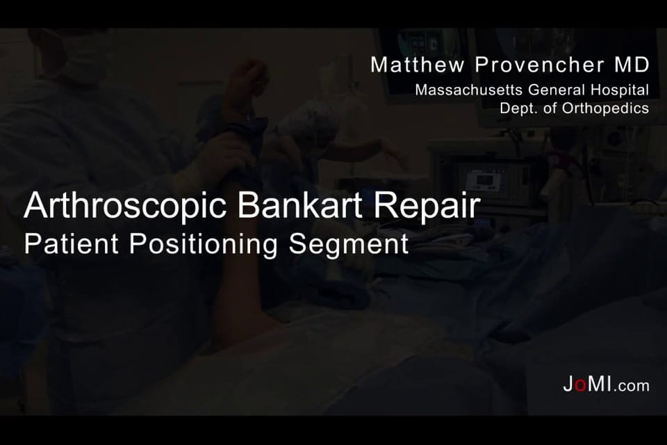 Lateral Patient Positioning for Shoulder Arthroscopy | JOMI