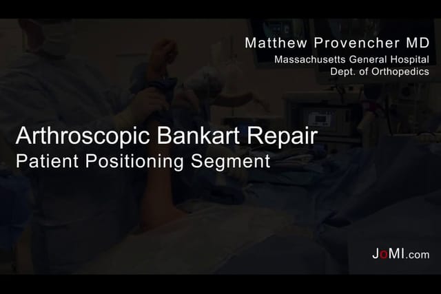 Lateral Patient Positioning for Shoulder Arthroscopy | JOMI