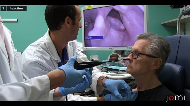 Inyección transcervical de las cuerdas vocales (en el consultorio) | JOMI