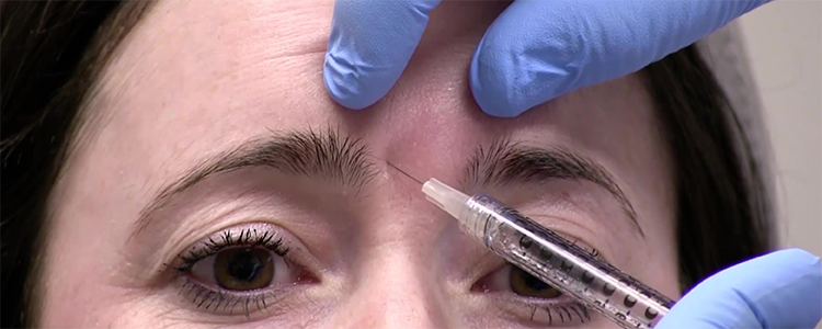 Botox Injection | Journal of Medical Insight